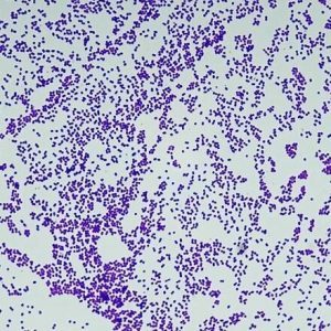 Gram Positive vs Gram Negative Bacteria | ORAPI Asia